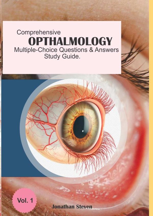 Comprehensive Ophthalmology Multiple-choice Questions And Answers Study Guide - Caimán Editores ...